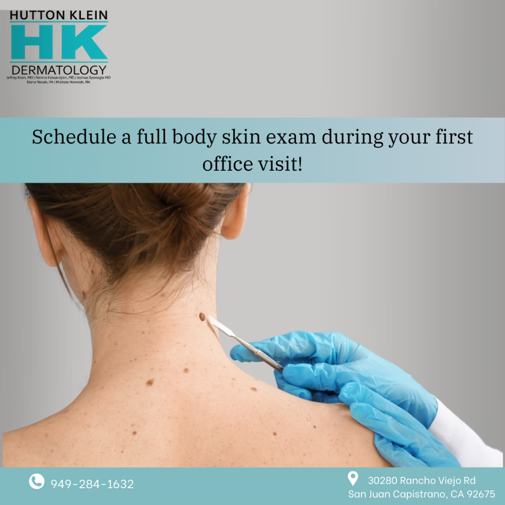 Dysplastic Nevi (Moles) in San Juan Capistrano, CA | HK Dermatology